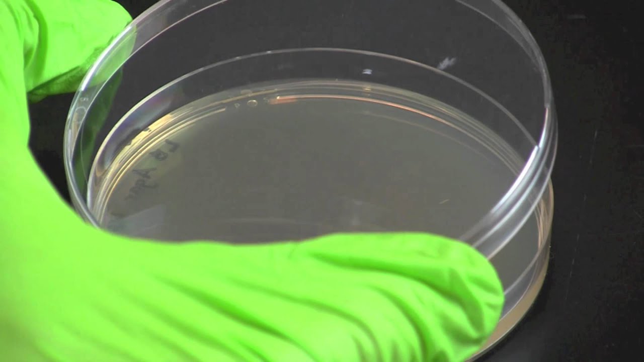 Mastering the Streak Plate Technique for Bacterial Isolation | Galaxy.ai