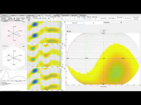Synchogram "movie" - Robinson Projection