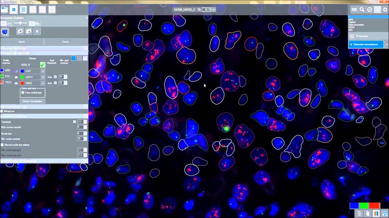 3DHISTECH - FISHQuant module