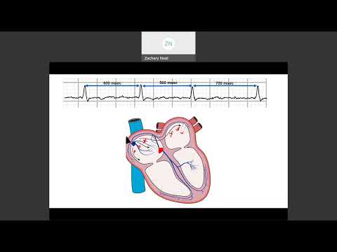 UMMC ECG Overview