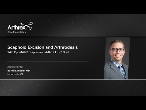 Scaphoid Excision and Arthrodesis With DynaNite® Staples and ArthroFLEX® Graft