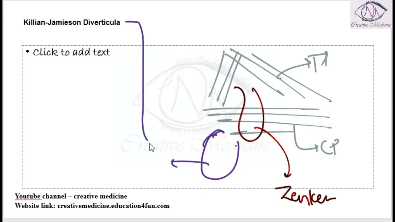 Lec 1 Killian Jamieson Diverticula mp4 || Esophagus