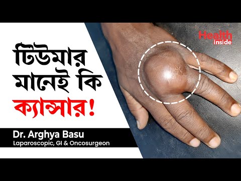 টিউমার মানেই কি ক্যান্সার, টিউমার এর প্রকারভেদ এবং চিকিৎসা | Are all tumours cancerous | tumour type