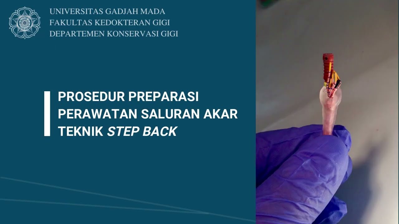 PSA Teknik Step Back