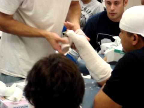 Short Arm Thumb Spica Non-remov Splint Application