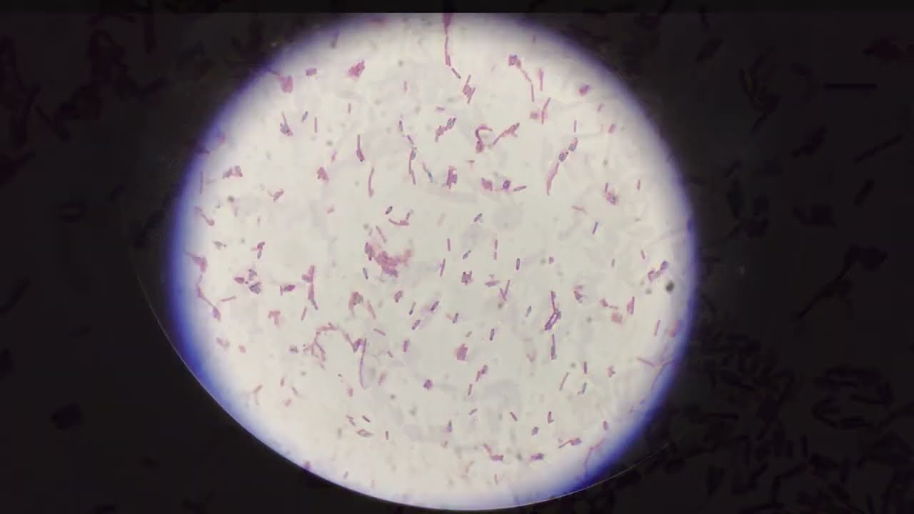 Staining of Bacterial Spores. Schaeffer-Fulton Technique. Microbiology. UGR