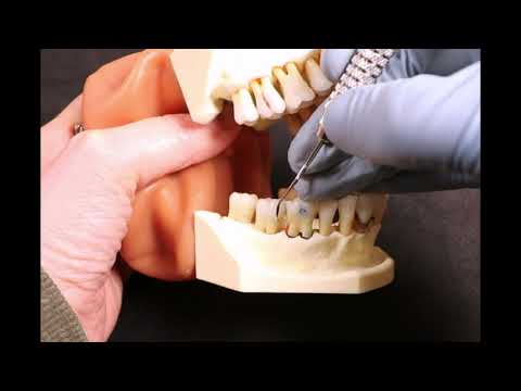 Best  Dental Hygiene Instruments to use and sharpen!!!!