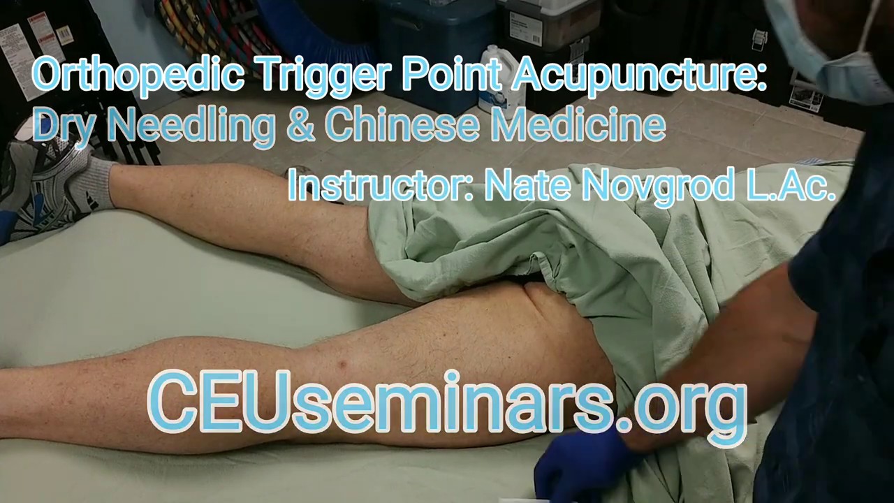 Orthopedic Trigger Point Acupuncture: Dry Needling & Chinese Medicine - Hamstrings