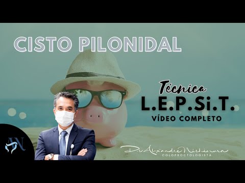 ✅ Técnica L.E.P.Si.T. - vídeo completo