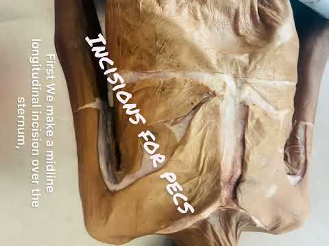 Cadaver Dissection of Chest Muscles | Pectoralis Major & Minor Explained #anatomy #mbbsstudent #bams