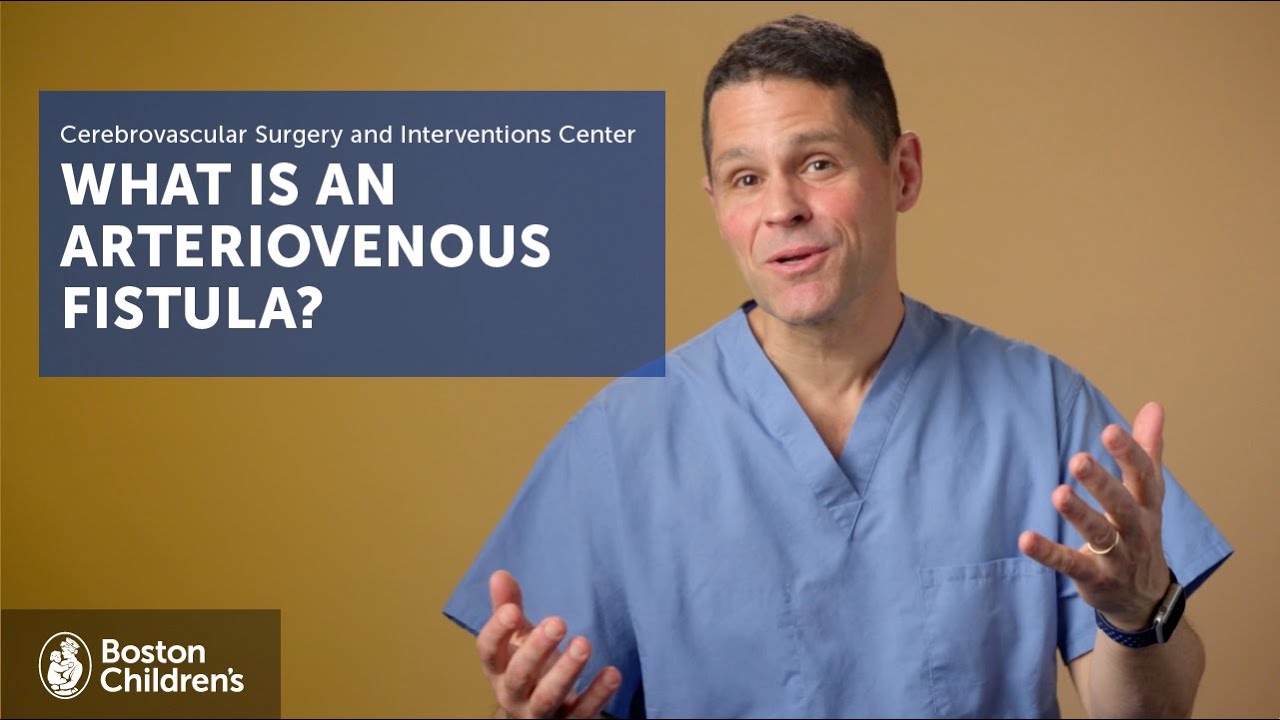 What are arteriovenous fistulas (AVFs)? | Boston Children's Hospital
