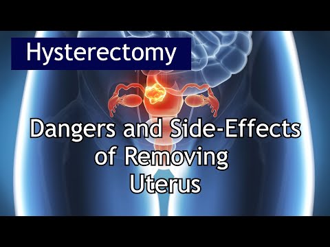 Hysterectomy: Dangers & Side Effects | Antai Hospital