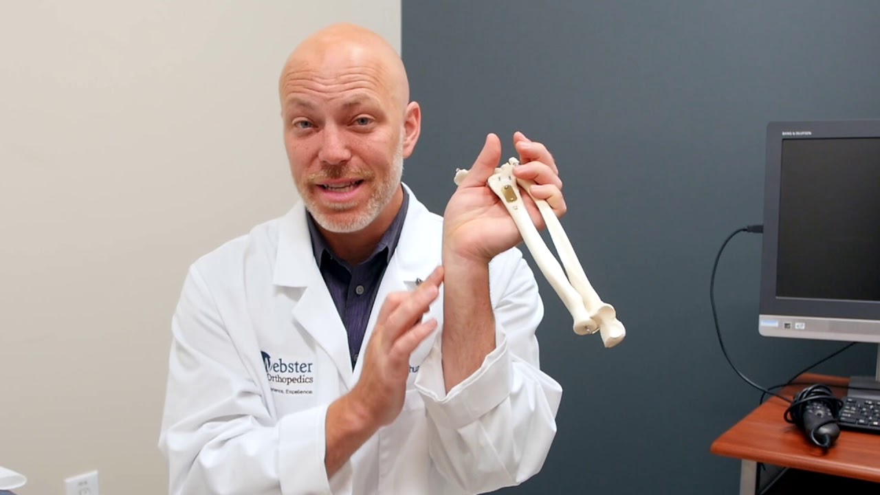 What to expect after distal radius/wrist fractures