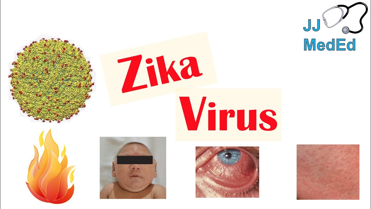 Zika Virus Infection | Transmission, Congenital Defects, Symptoms & What You Need To Know