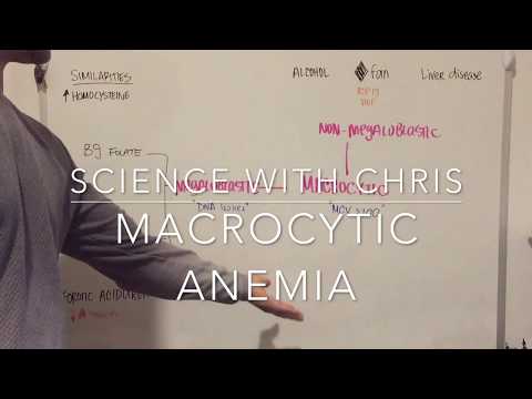 Macrocytic Anemia: Easily Explained