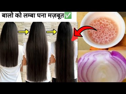 7 days Challenge : Onion juice for stop Hairfall