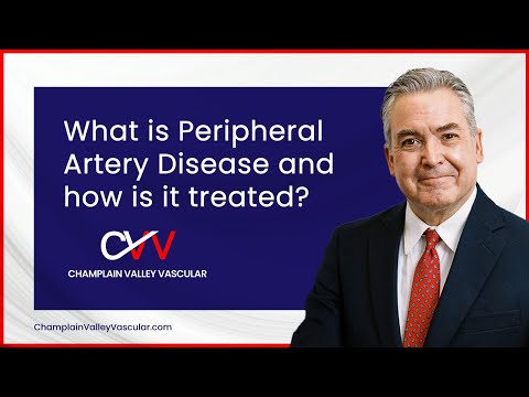 What is Peripheral Artery Disease and How is it Treated?