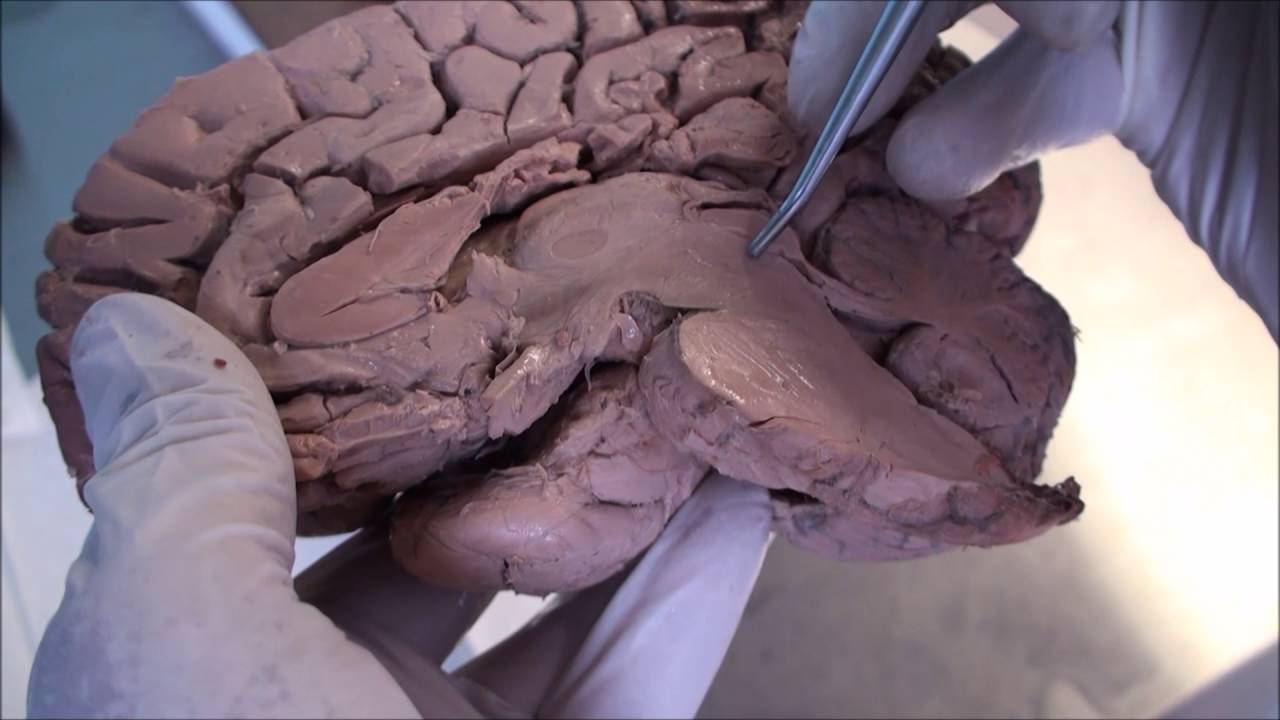 Video 5 Mesolimbic Tract