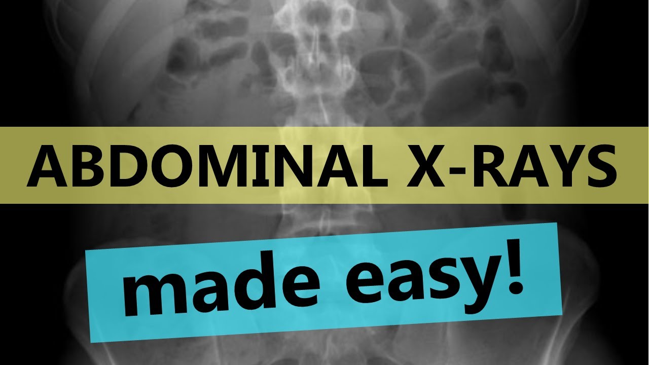 How to read abdominal x-rays | EASY GUIDE