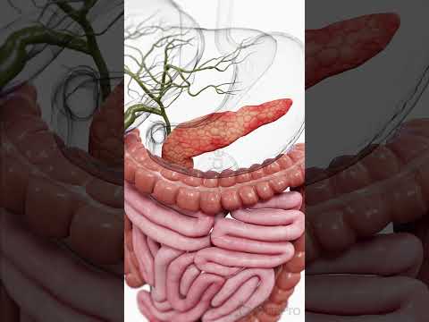 🔥 Pancreatitis: When the Pancreas Turns Against Itself 🔥  #medicalanimation #anatomy