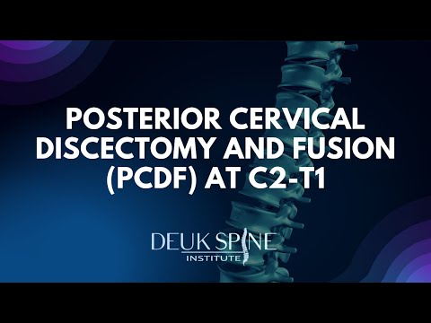 Watch LIVE PCDF Cervical Spinal FUSION - C2-T1 (Q&A W/ Dr. Deuk)