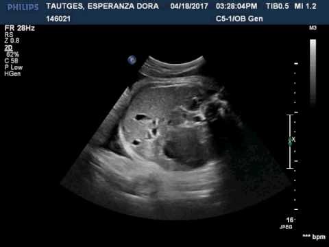 T-Minus 1 Week! – IVF/Surrogacy Journey Blog