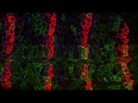 Adenomatous polyposis coli tumour suppressor