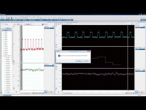 LabChart Mastery 如何使用Scope, Peak Analysis and Spike Histogram
