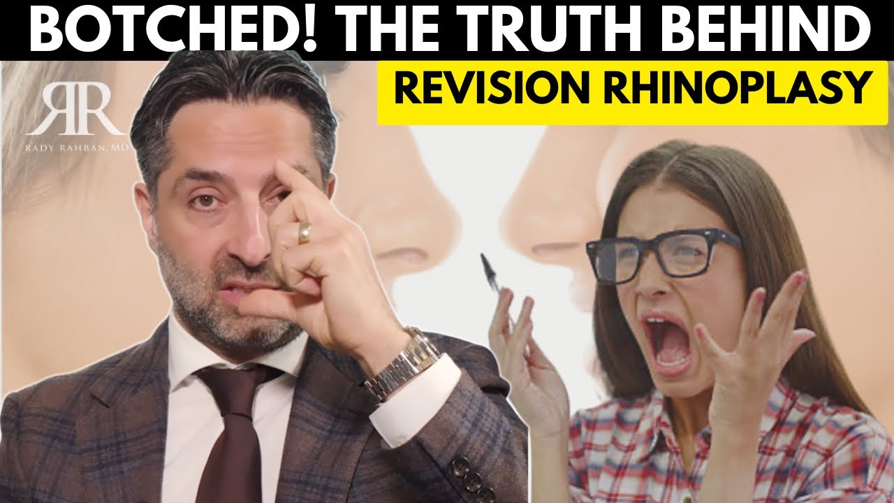 The Unspoken TRUTH About Revision Rhinoplasty #plasticsurgery #rhinoplasty #losangeles