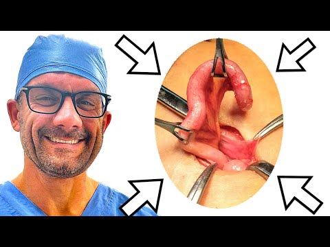 The Mysterious Function and Benefit of the Appendix
