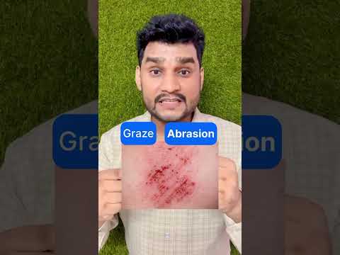 Vocabulary related to injuries #ytshorts #english #learnenglish #grammar #vocabulary #education