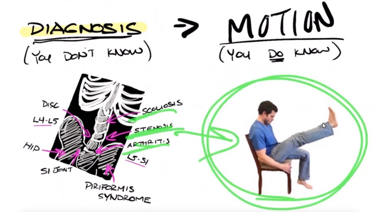 Why Your Sciatica Keeps Coming Back