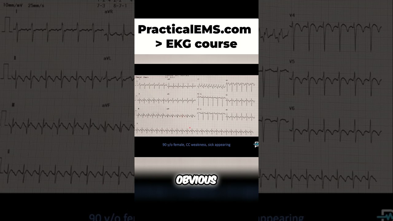 ER Diagnoses 2:1 Atrial Flutter: EKG Explained! #shorts