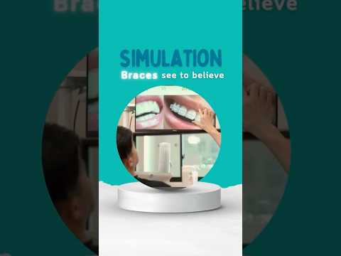 Curious about how AI-powered dental scanners work in dentistry? Seeing is believing β¨π¦·