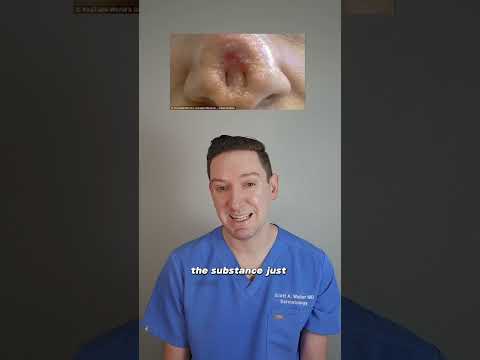 Home Remedies for Skin Cancer: Do they work? A dermatologist explains #blacksalve #skincancer