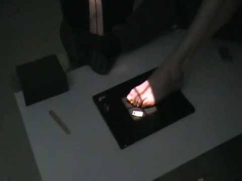 Adult Toes-AP,Oblique and Lateral « Medical Radiology - Canada, Winnipeg