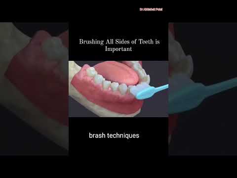 New brash technique ,#bds #anm #facts #dentist