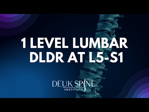 Endoscopic Laser Rhizotomy L5-S1