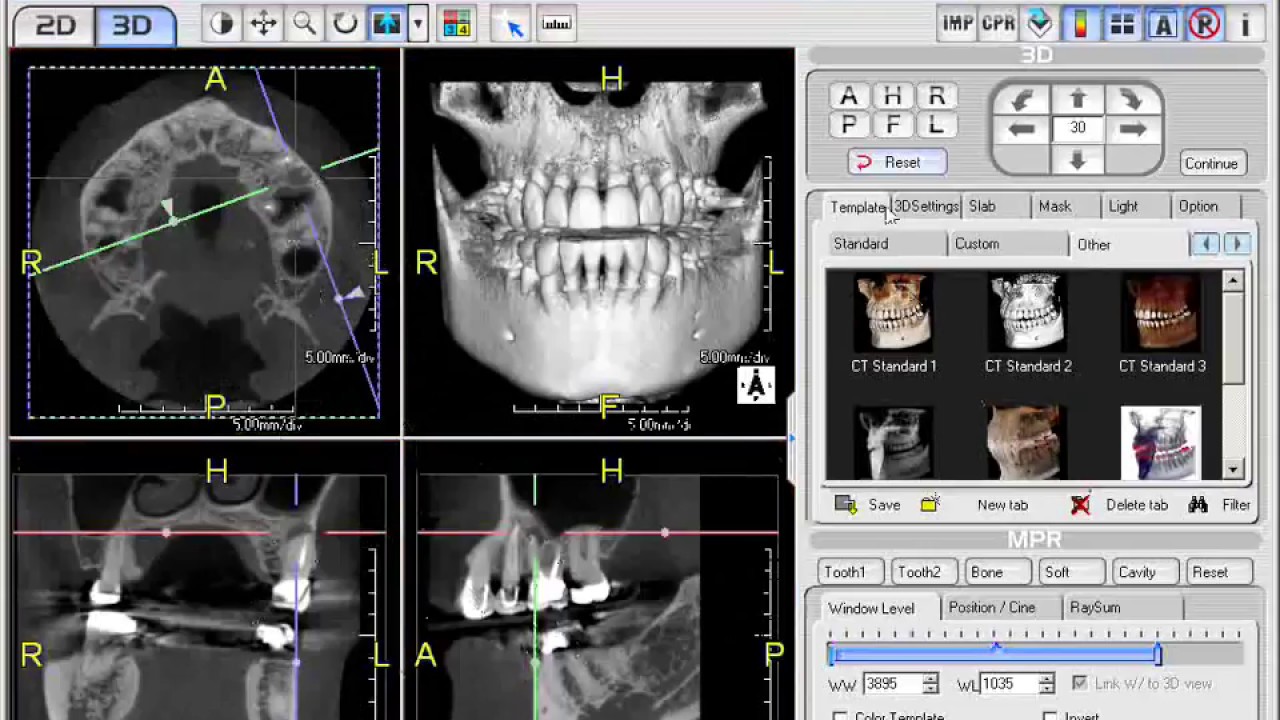 PreXion Dynamic Image Manipulation