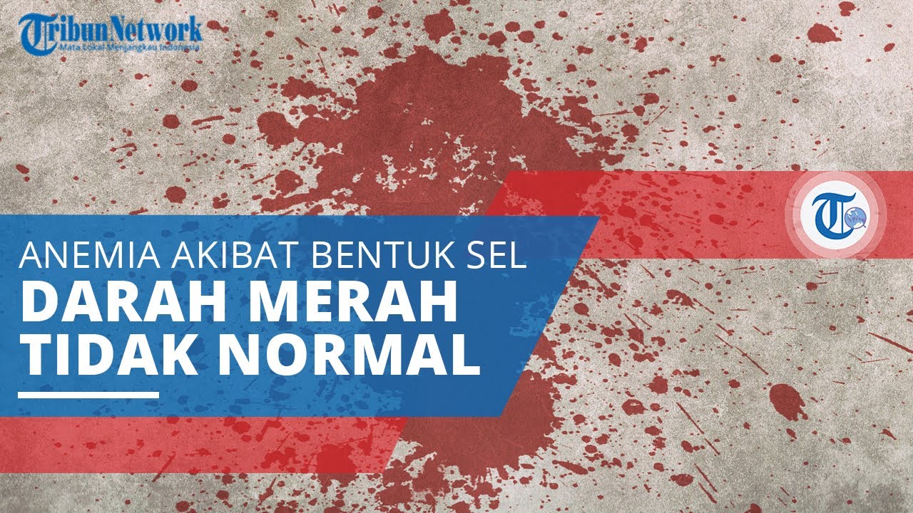 Anemia Sel Sabit, Anemia akibat Kelainan Genetik Yaitu ketika Bentuk ...