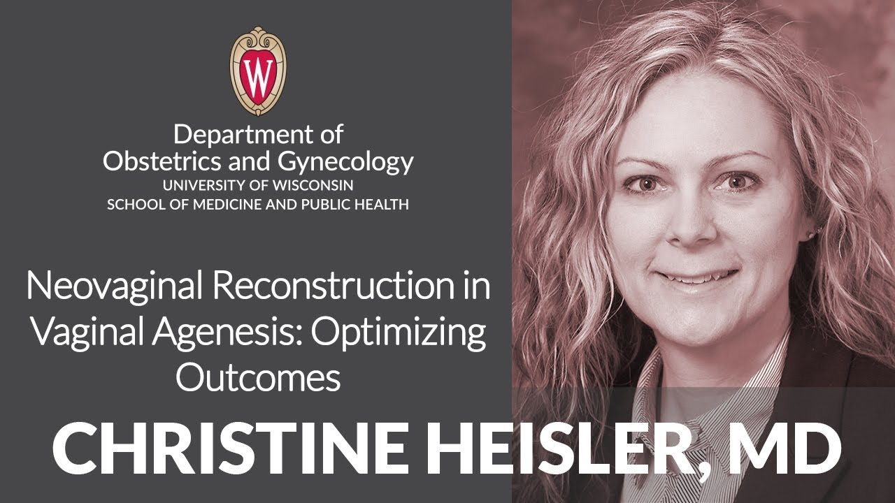 Neovaginal Reconstruction in Vaginal Agenesis: Optimizing Outcomes