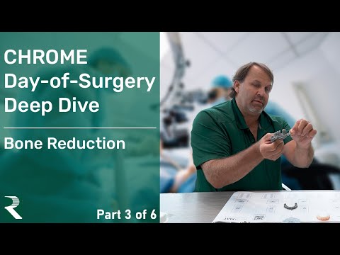 CHROME Day-of-Surgery Deep Dive: Bone Reduction (Part 3)