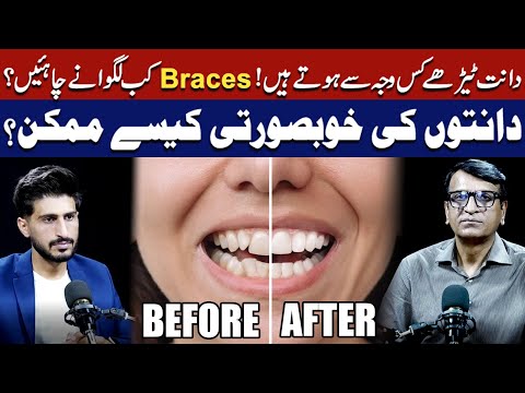 Dant Tehri Honay Ki Wajahat Aur Braces Kab Lagwane Chahiye | Dr. Farooq Khan