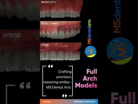 Full Arch Models by MS Dental Arts Lab