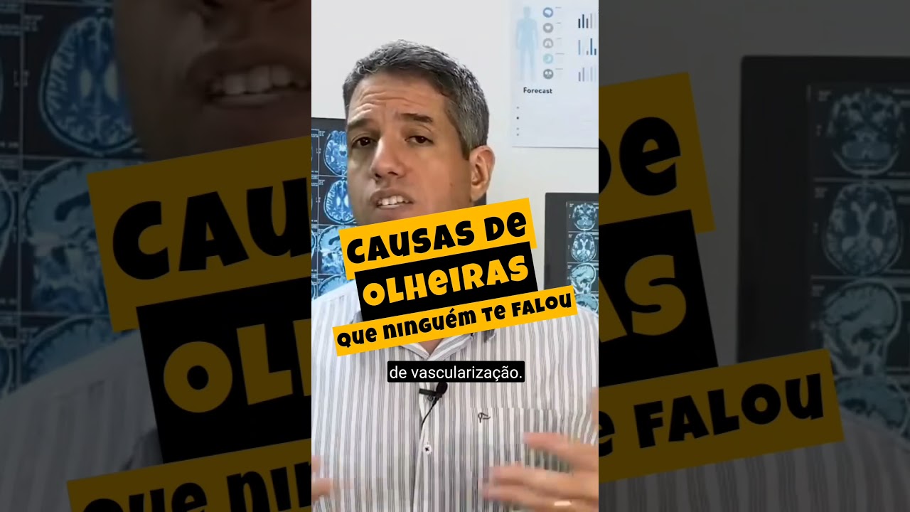 Dark Circles Under Eyes - A Hidden Cause! Dr. Alain Dutra