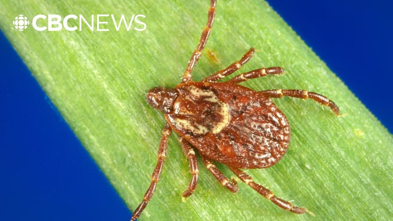 Rocky Mountain spotted fever: what you need to know