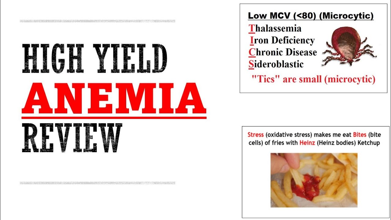 Anemia Review | Mnemonics And Proven Ways To Memorize for your exams!