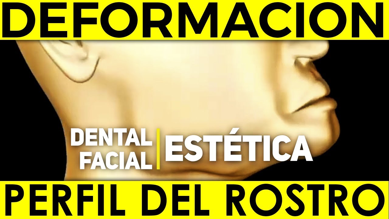 ¿Los BRACKETS cambian la FORMA DEL ROSTRO? Estos son los Beneficios DESPUÉS de la ORTODONCIA