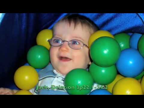 Chromosome Disorder Outreach (CDO) YouTube Video