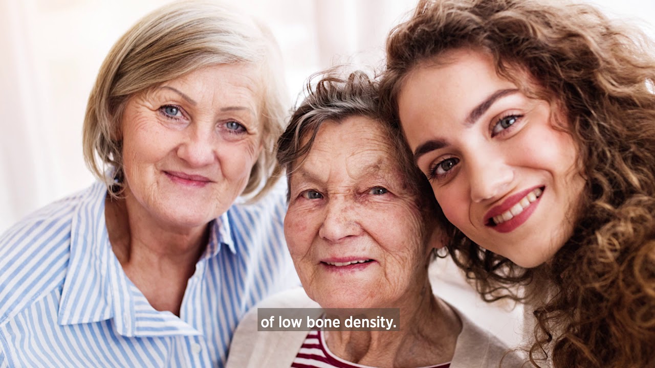 DXA Scan for Bone Density (Froedtert & MCW Rayus Radiology)